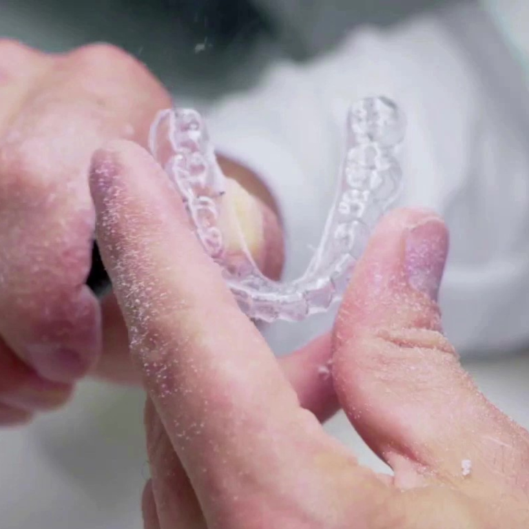 Gouttière Orthodontie - Prix et Options de Gouttières Orthodontiques ...